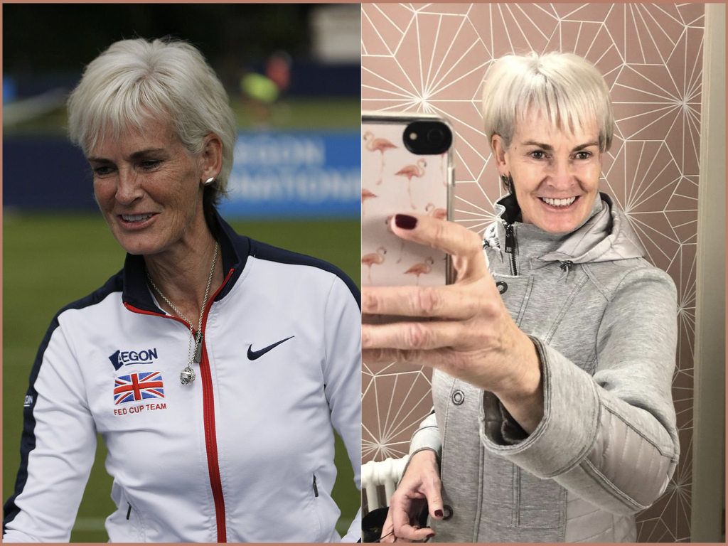 Morpheus 8: All you need to know about Judy Murray’s facelift ...