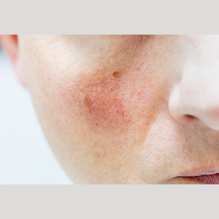 From Damaged to Glowing: My Skin Barrier Recovery Story | Notorious-mag